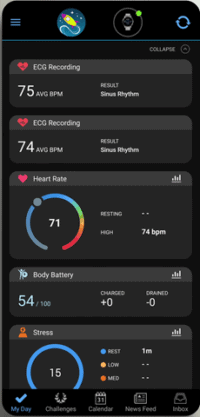 Garmin ECG Feature Is Now Live: Here’s how it works! | DC Rainmaker