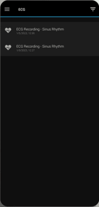 Garmin ECG Feature Is Now Live: Here’s how it works! | DC Rainmaker