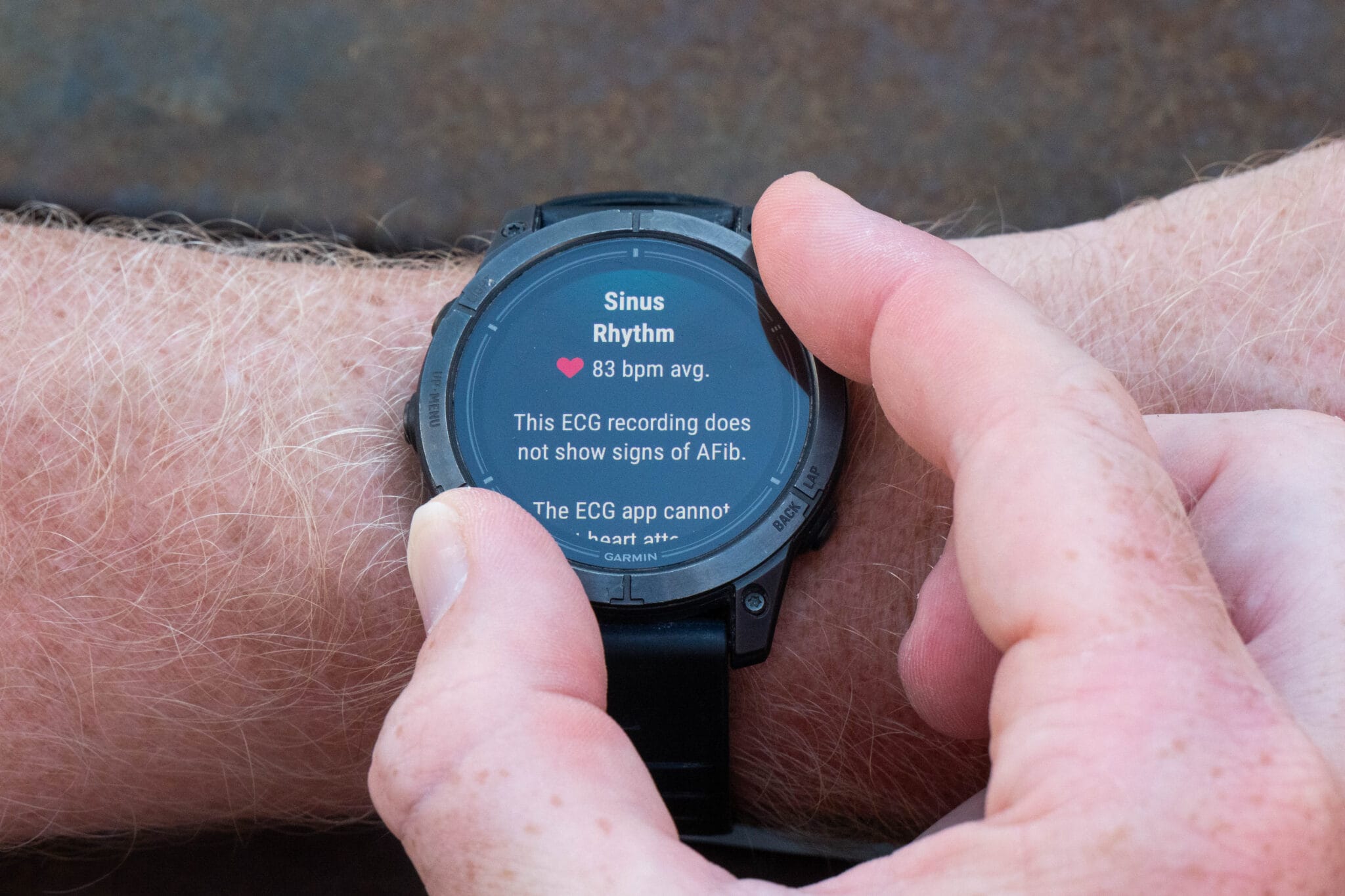 How to use Garmin ECG Feature: Fenix 7 Pro, Epix Pro, Fenix 8, and Venu ...