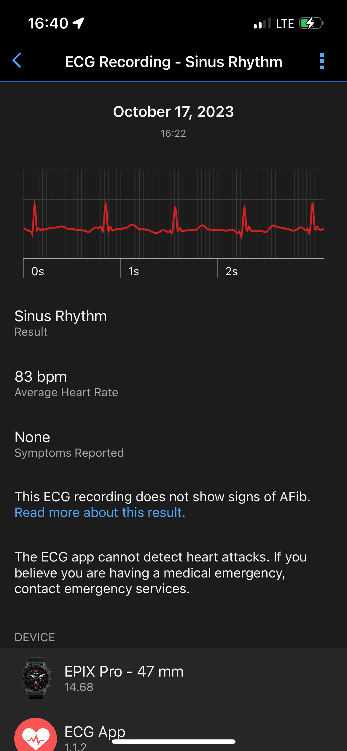 How to use Garmin ECG Feature: Fenix 7 Pro, Epix Pro, Fenix 8, and Venu ...