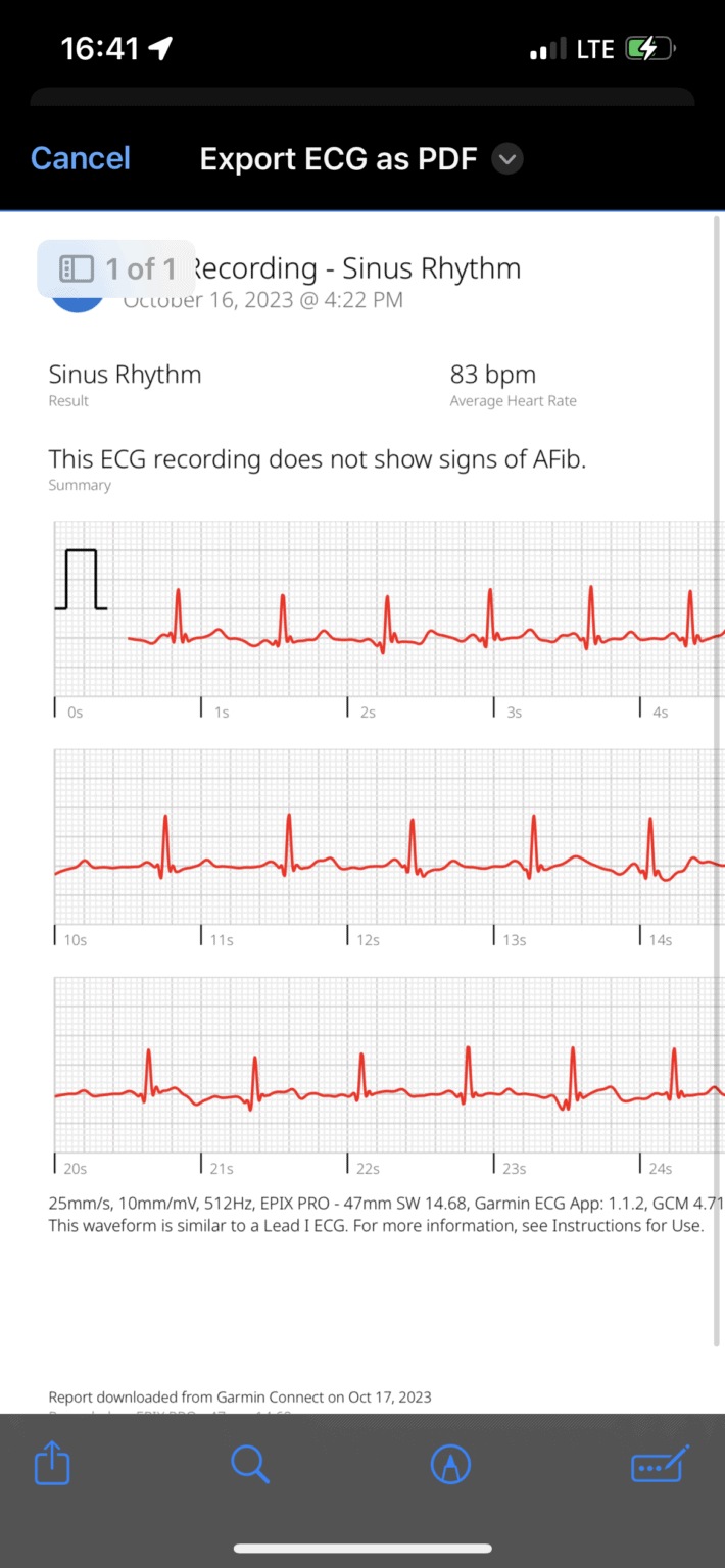 How to use Garmin ECG Feature: Fenix 7 Pro, Epix Pro, Fenix 8, and Venu ...