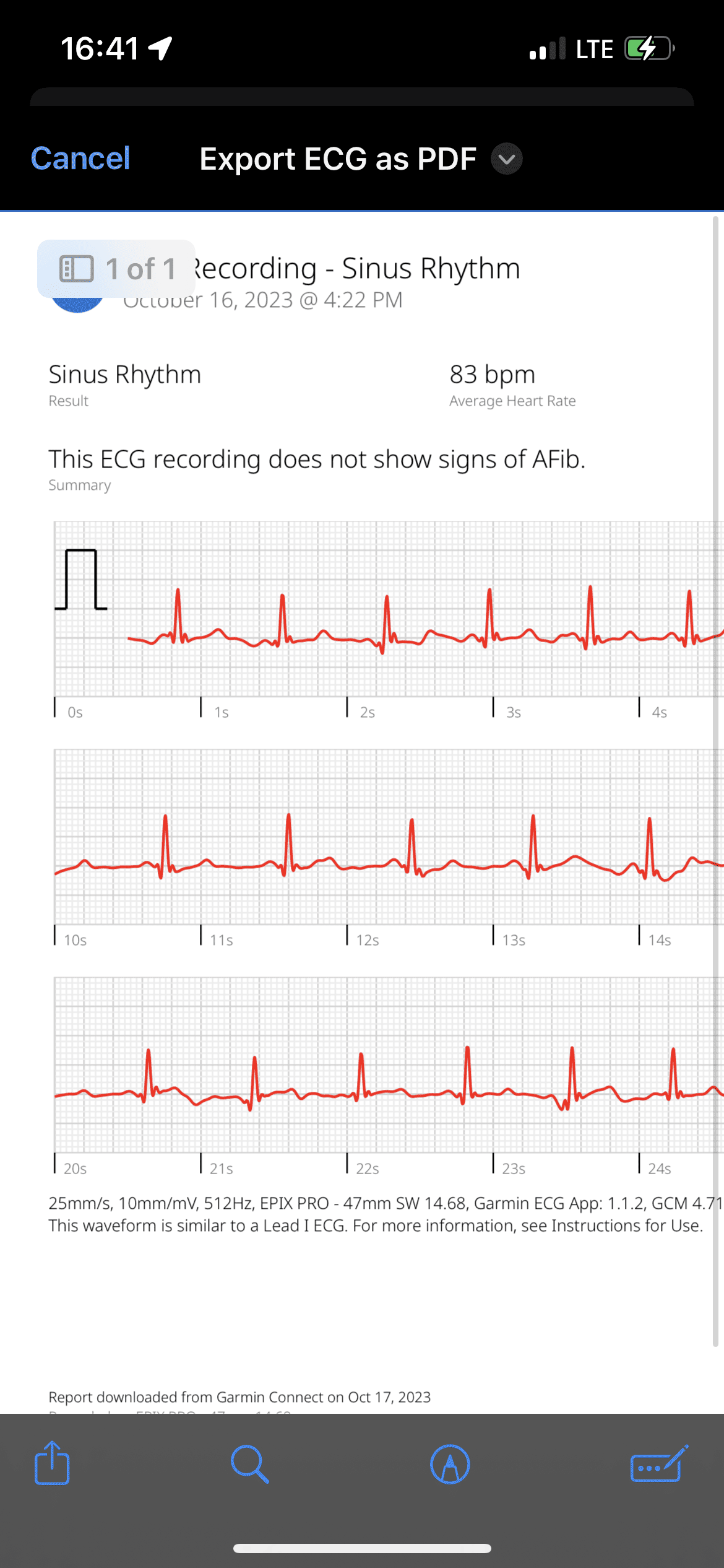 Garmin Expands ECG Feature to More Watches: How to Use It | Smart Health