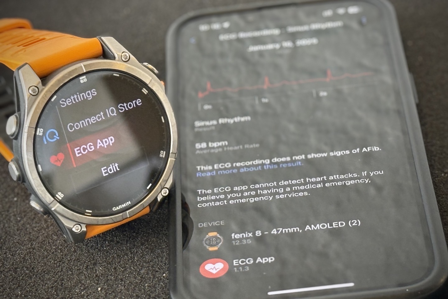 Garmin ECG Now Available in EU & Australia